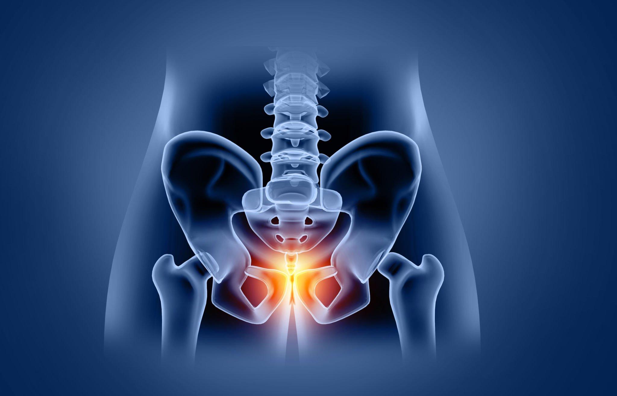 Pelvis Trauma - Orthopedics Kerala